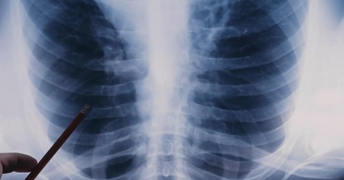 19/3 - 03:35 | Still a Mystery på Kanal 5